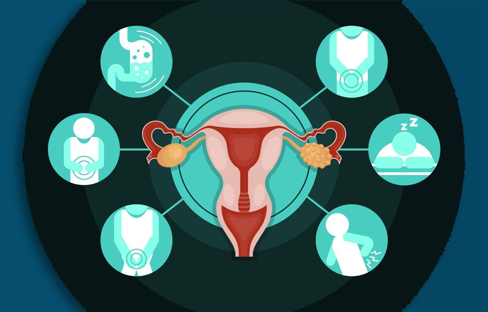 Over (Yumurtalık) Kanseri Belirtilerini Tanımak, Yanlış ve Geç Teşhisi ...