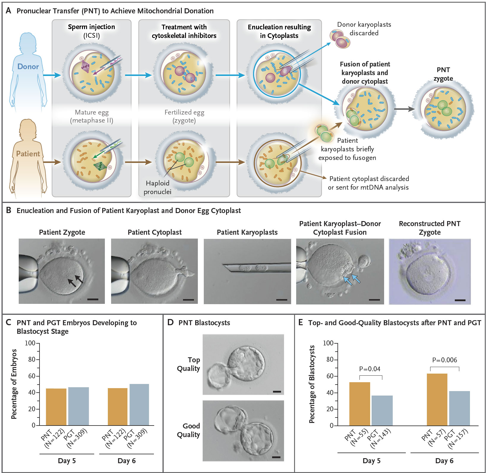 Revolutionizing Mitochondrial Disease Prevention: The Three-Parent Baby ...