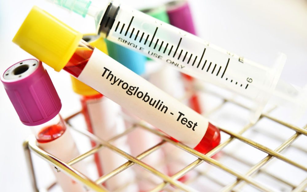 Tiroglobulin Testi Nedir? Yüksekliği ve Düşüklüğü Neden Olur? Tedavisi ...