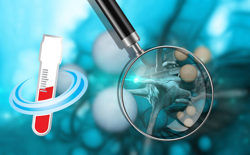 Kan testi ile kanserde ERKEN TANI – çok fazla yanlış pozitif! | Prof ...