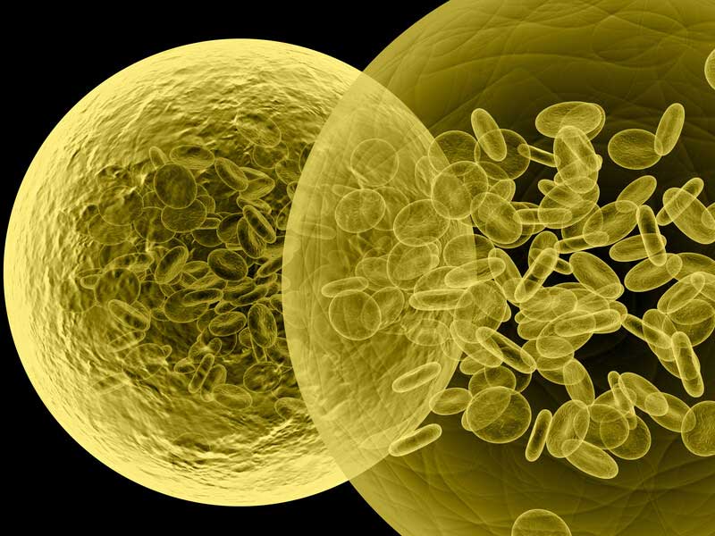 Karaciğer yağlanmasına ne iyi gelir ve nasıl geçer? | Prof. Dr. Mustafa ...