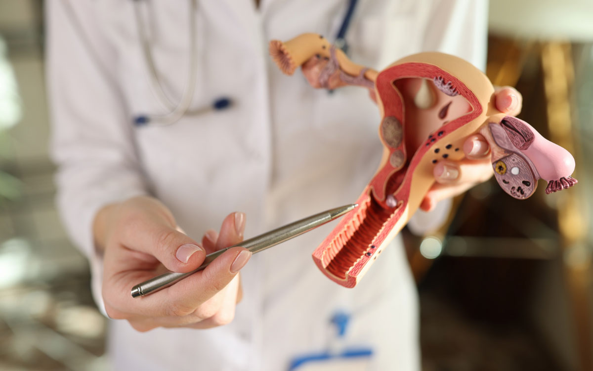 Over (Kadın Yumurtalık) Kanseri Tedavisinde Yenilikler – 2023 | Prof ...